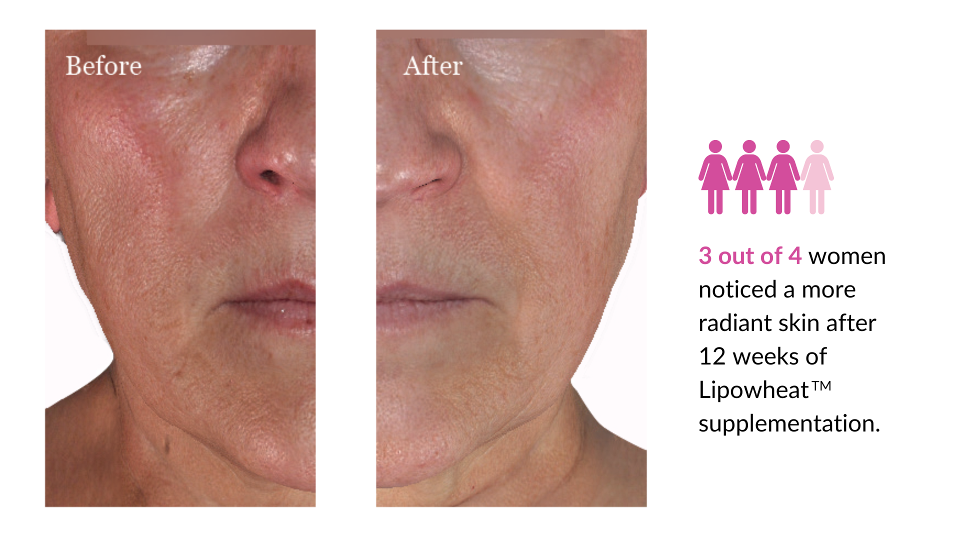 Lipowheat™ – Premium Nutricosmetic Ingredient for A Younger Looking Skin